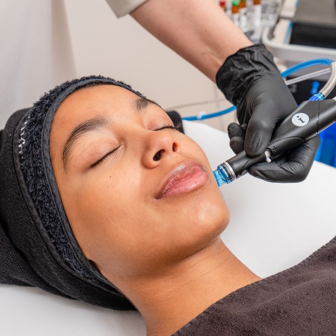 Get Ready to Glow with HydraFacial Treatments - Dolce Vita Wellness Spa